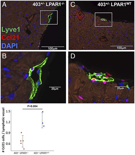 Ablation Of Lysophosphatidic Acid Receptor 1 Attenuates Hypertrophic