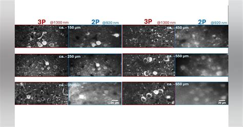 Three Photon Microscopy Comes Of Age Laser Focus World