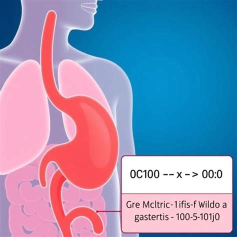 A Comprehensive Guide To Icd 10 Codes For Gastritis Wmwtl