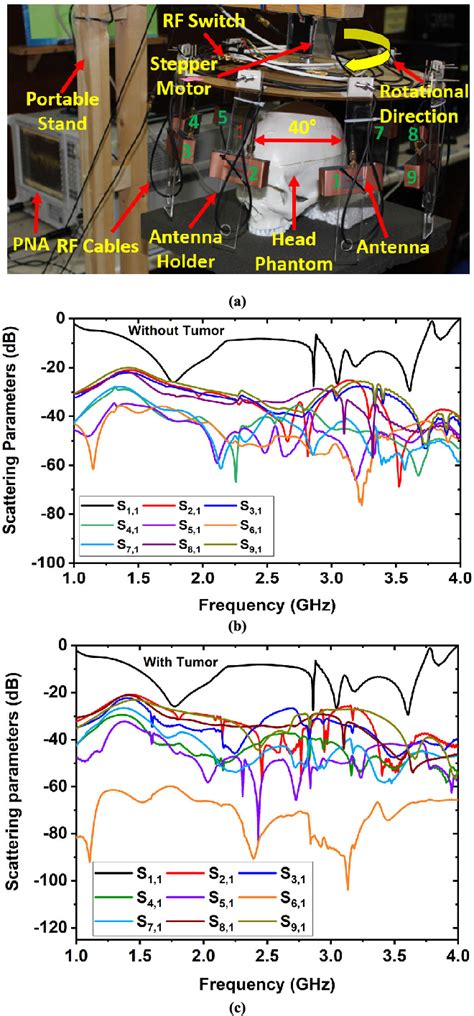 Figure 1 From A Yolov3 Deep Neural Network Model To Detect Brain Tumor In Portable