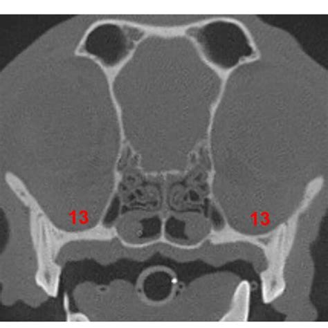 Figure Grid For The Ioc Relative To The Mesial Roots Of The Pp Download Scientific Diagram