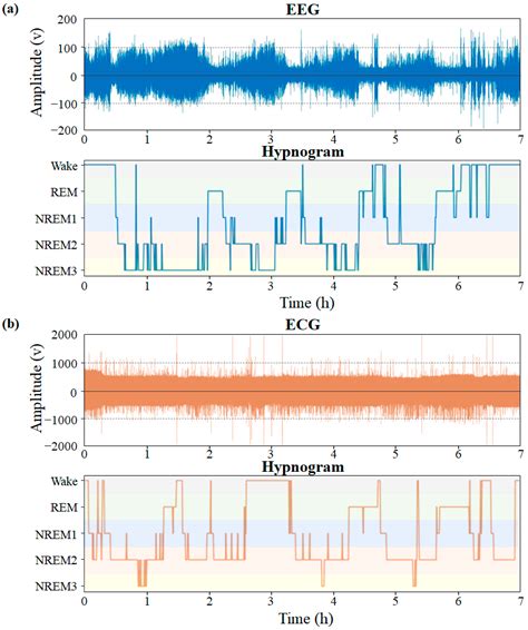 Cross Domain Transfer Of Eeg To Eeg Or Ecg Learning For Cnn