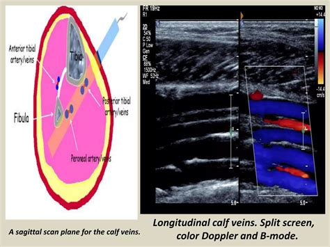 Presentation1pptx Radiological Vascular Anatomy Of The Upper And
