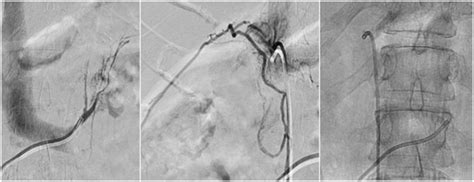 Venous Samplings Department Of Radiology