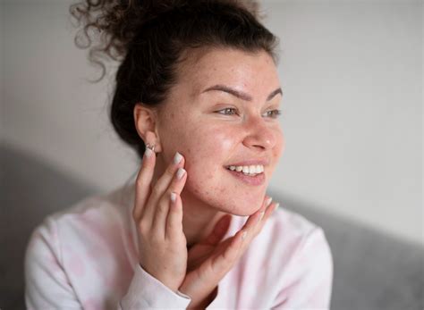 Acne Vs Pimples The Difference And How To Treat Each Buyers Report