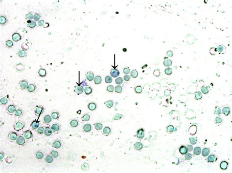 Eritrocitos Corpúsculos Sanguíneos Rojos Corpúsculos Rojos Sanguíneos