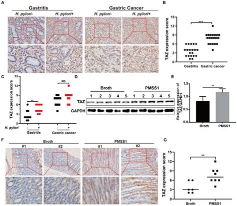 Taz Expression Levels In Human Gastric Tissues And Ins Gas Mice