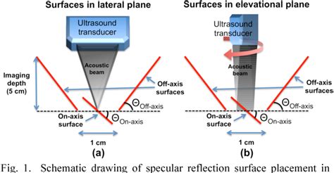 Specular Reflection Ultrasound