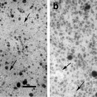 Electron micrographs of native Se⁰ nanoparticle samples a Particle Download Scientific