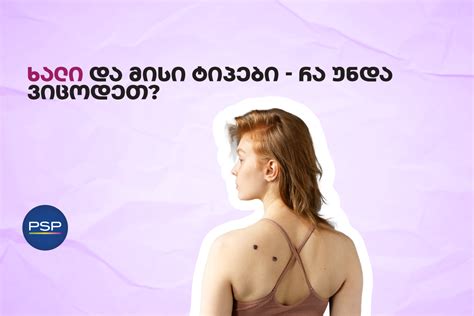 ხალი და მისი ტიპები — რა უნდა ვიცოდეთ