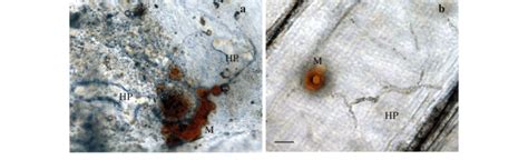 Montage Of Photomicrographs Of Spore Cyst Attached To The Download Scientific Diagram
