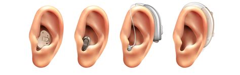 A Comprehensive Guide To Different Types Of Hearing Aids Blaids Hearing