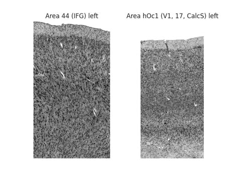 multimodal comparison of two cortical brain areas — siibra python