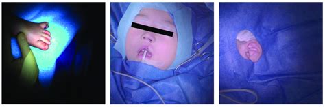 Examples Of None Feature Rich Frames Each Shows One Of Five View Download Scientific Diagram