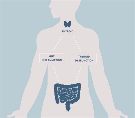 Best Thyroid Health Miami Fl Dr Jason Shapiro