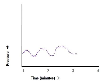 Correlation Of Icp Waveforms With Intracranial Pathology Deranged