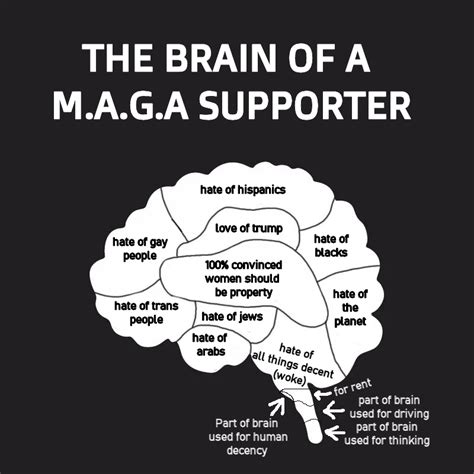 Maga Supporters Brain X Ray Album On Imgur