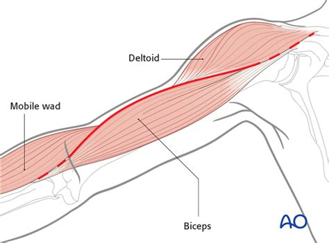 Anterolateral Approach To The Humerus After Henry