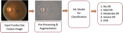 Typical Model Architecture For Diabetic Retinopathy Detection Download Scientific Diagram