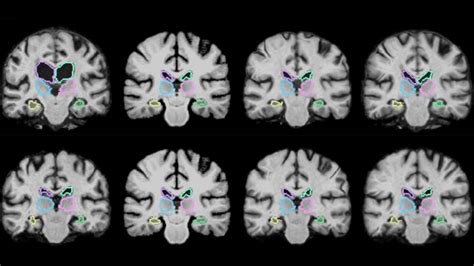 Mit Deep Learning Algorithm Finds Hidden Warning Signals In