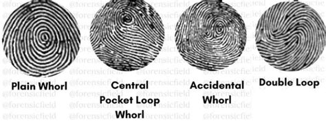 Types Of Fingerprint Patterns Forensics Blog Types Of Fingerprints Radius And Ulna Forensics