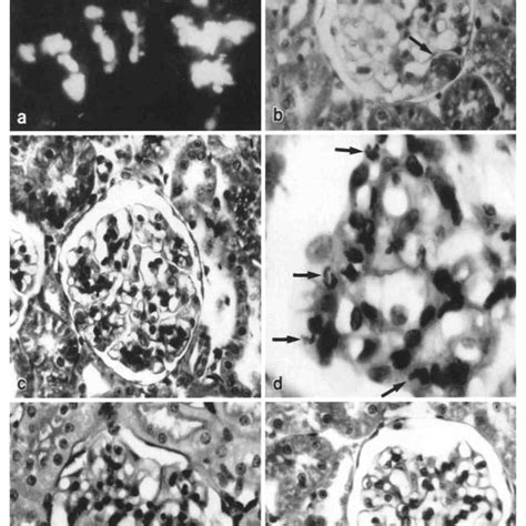 Electron Microscopy Of A Mononuclear Phagocyte In A Glomerular