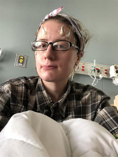 82 Best Eeg Images On Pholder Epilepsy Pics And Cogsci