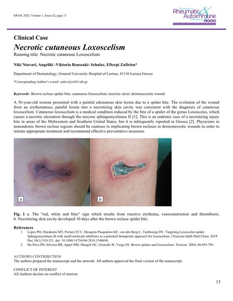 Pdf Necrotic Cutaneous Loxoscelism