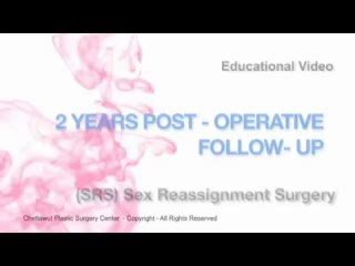 Sex Reassignment Surgery DaftSex