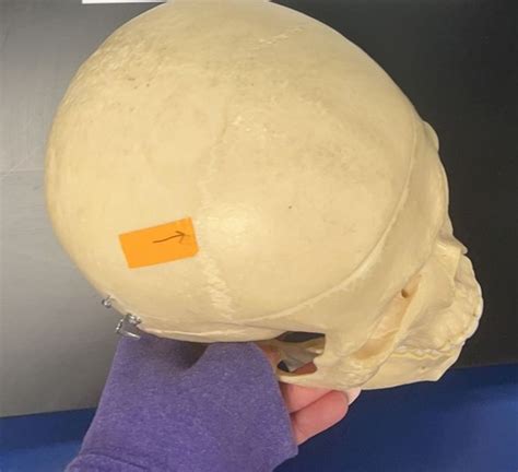 Joint Classification Flashcards Quizlet