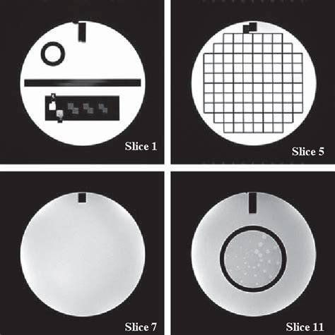 mri quality assurance using the acr phantom in a multi unit imaging