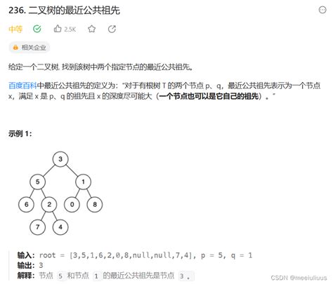 Leetcode236 二叉树的最近公共祖先 Hot100 面试必考精华版 Csdn博客