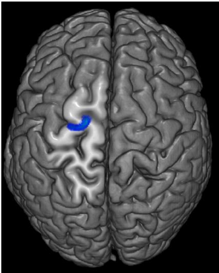 Spm Depicting Region In Left Dorsal Premotor Cortex Where Lower Download Scientific Diagram