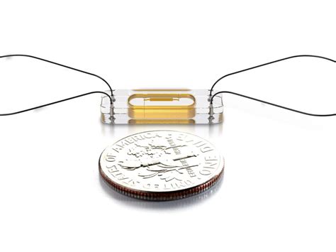 Abbott The Cardiomems Hf System Cardiac Rhythm News