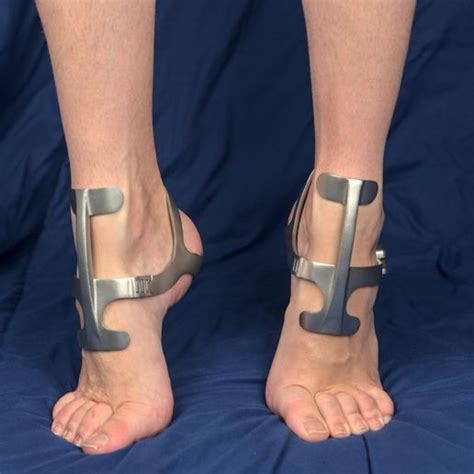 🦶 Ankle Cage V2・free Stl File For 3d Printing・cults