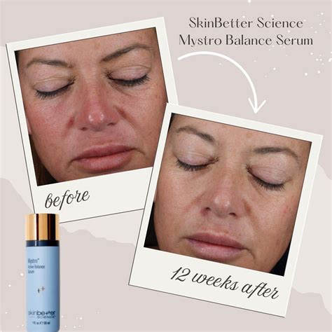 Skin Source Before And After See The Transformative Facebook