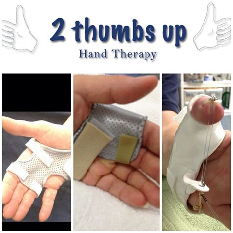 Custom Splints Orthoses Hand Therapy Occupational Therapy Orthosis