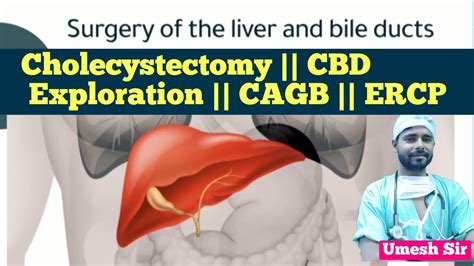 Cholecystectomy Cbd Exploration Cagb Ercp Gastro Surgery Medical Hospital
