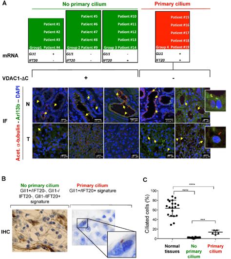 Identification And Validation Of The 2 Gene Signature Predictive Of The