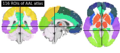 Figure 2 From A Deep Learning Approach To Predict Autism Spectrum Disorder Using Multisite