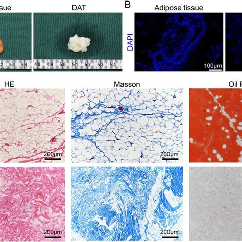 Characteristics Of Dat A The Macroscopic View Of Adipose Tissue And