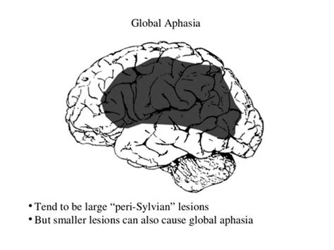 Boston Classification System Of Aphasia Flashcards Quizlet