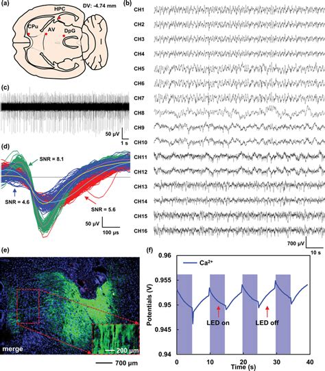 In Vivo Electrophysiological Recording And Ca²⁺ Monitoring A An Download Scientific Diagram