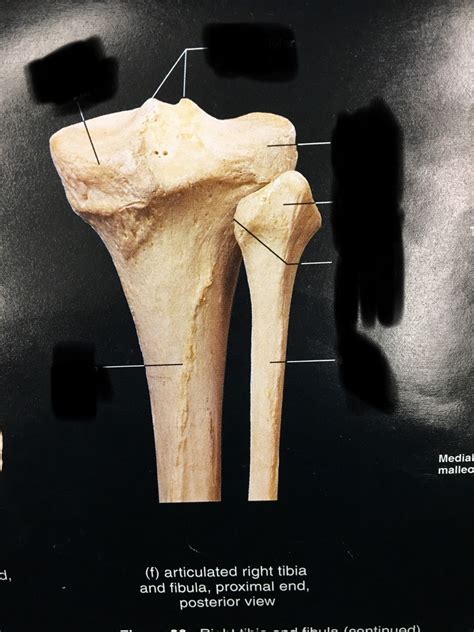 Anatomy And Physiology Chapter 7 Tibia And Fibula Prox End Diagram Quizlet