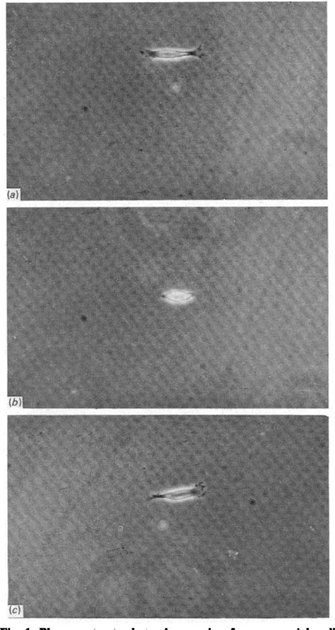 Table 1 From Phorbol Ester Inhibits Arginine Vasopressin Activation Of