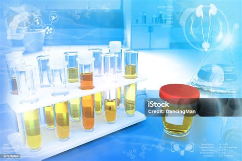 도핑 또는 탄산 칼슘에 대한 소변 샘플 테스트 현대 오염 대학 클리닉의 테스트 튜브 의학 3d 일러스트 산도 값에 대한 스톡 사진 및 기타 이미지 Istock