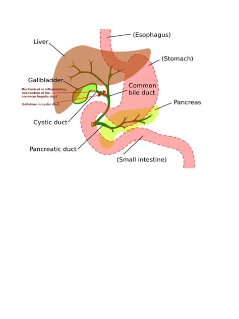 Obstructive Jaundice Pdf