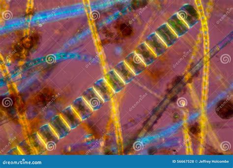Ulothrix A Freshwater Green Algae In A Polarizing Micrograph Stock