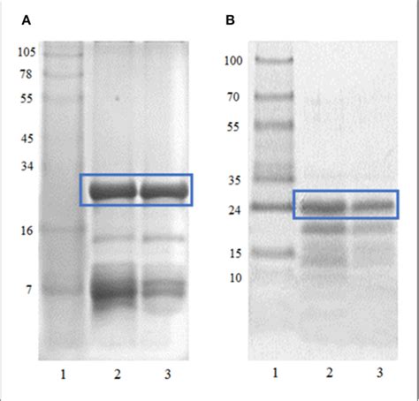 Figure From Biosynthesis Of A Novel Antibacterial Dipeptide Using Proteases From South