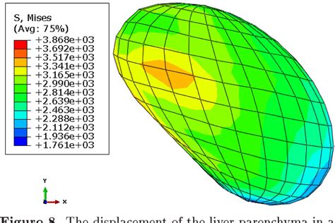 Figure 1 From Developing A Deformable Model Of Liver Tumor During